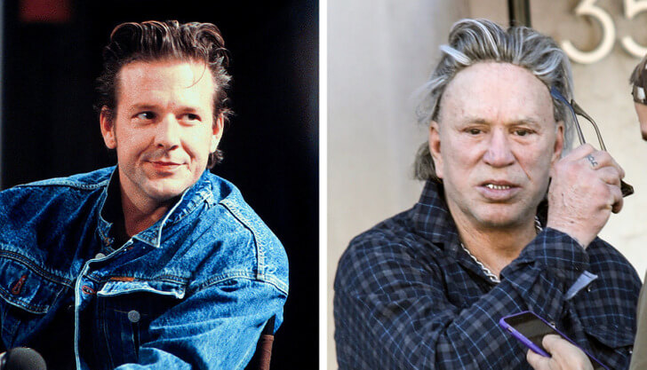 Mickey Rourke Plastic Surgery - Clinic Mono