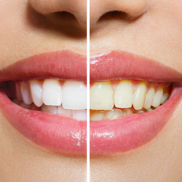 Change Your Life With Mono! - Clinic Mono in 2024