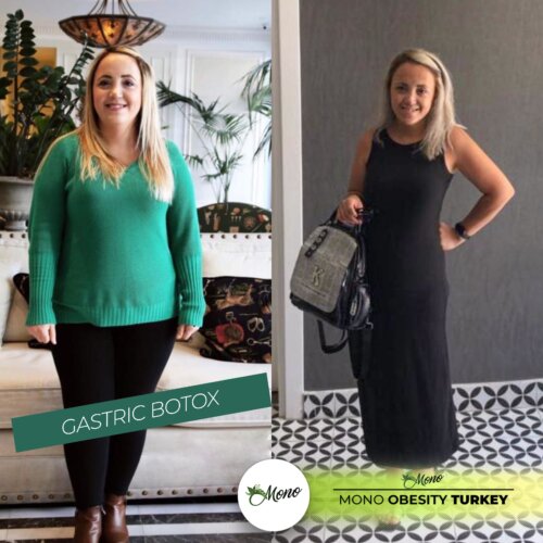 Gastric Botox in Turkey | Stomach Botox Injection Prices