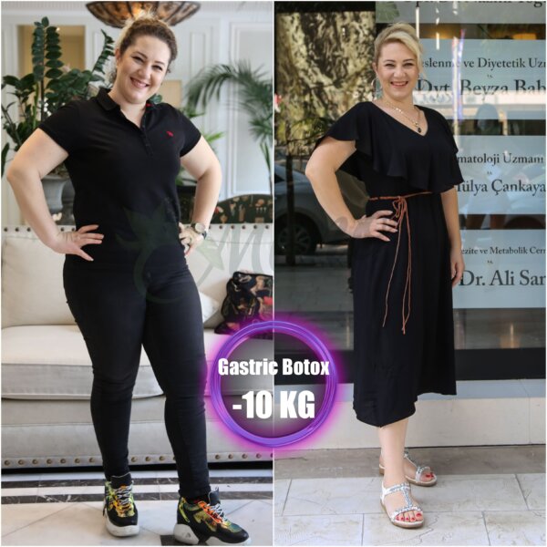 Gastric Botox in Turkey | Stomach Botox Injection Prices
