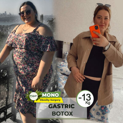 Gastric Botox in Turkey | Stomach Botox Injection Prices